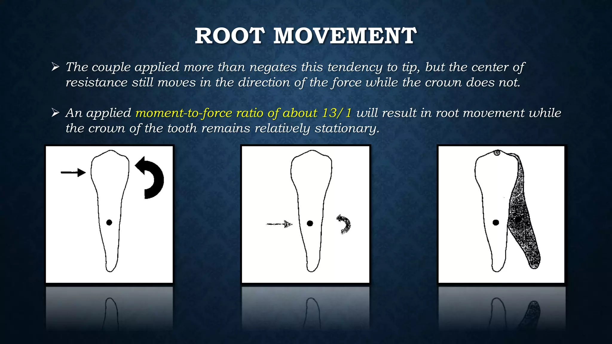 The basics of Orthodontic Mechanics | PPTX