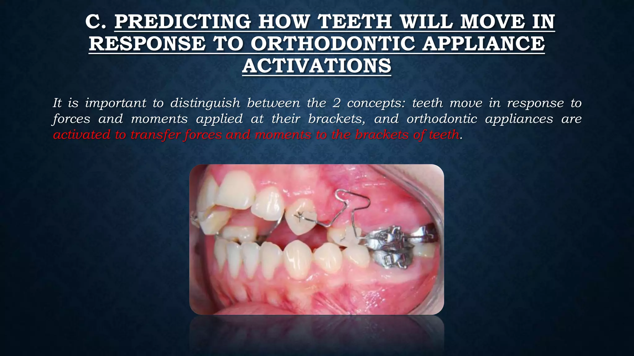 The basics of Orthodontic Mechanics | PPTX