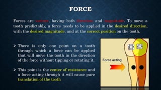 The basics of Orthodontic Mechanics | PPTX | Dental Health | Diseases ...