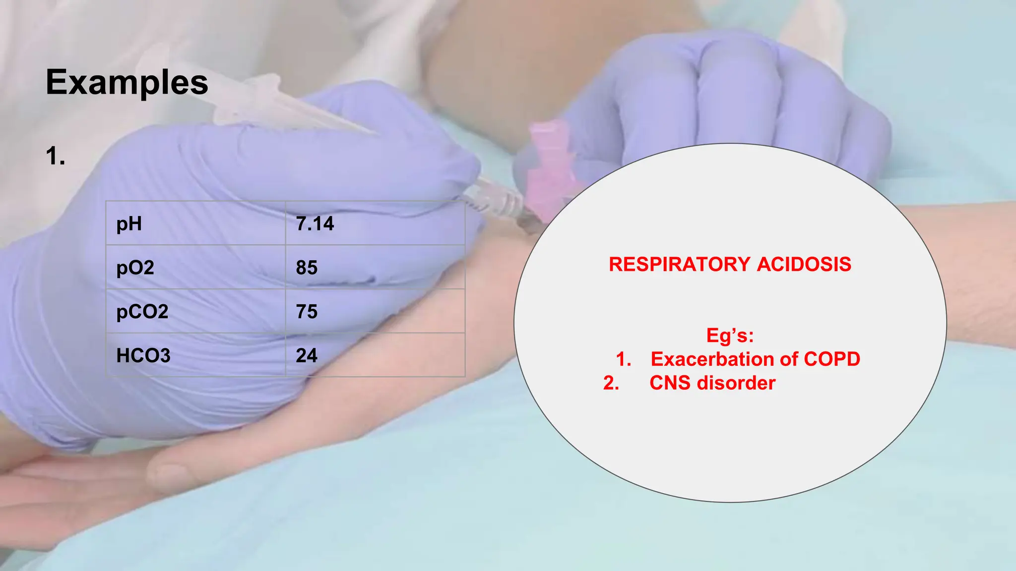 The Basics of ABG for nursing students.pptx