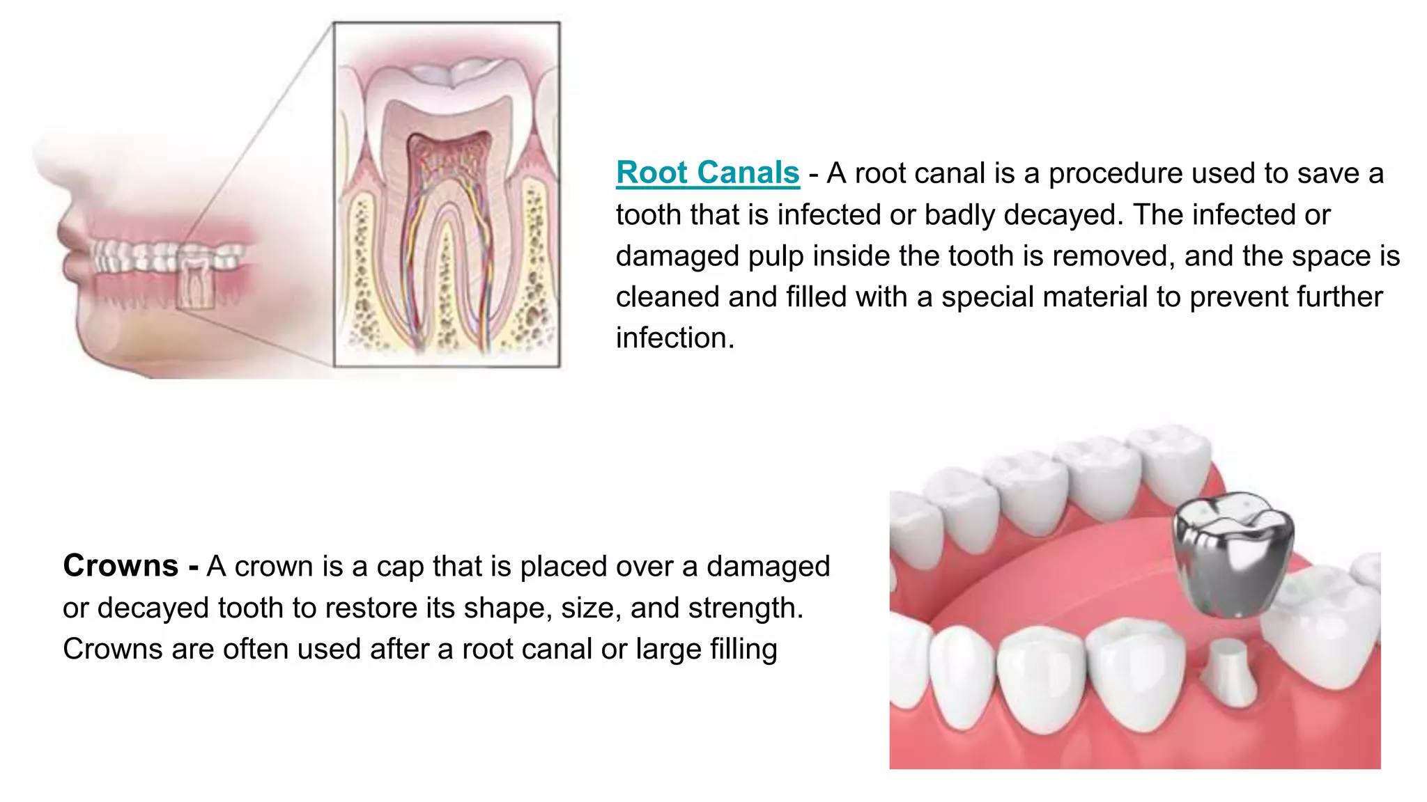 The Basics of Dentistry | PPTX