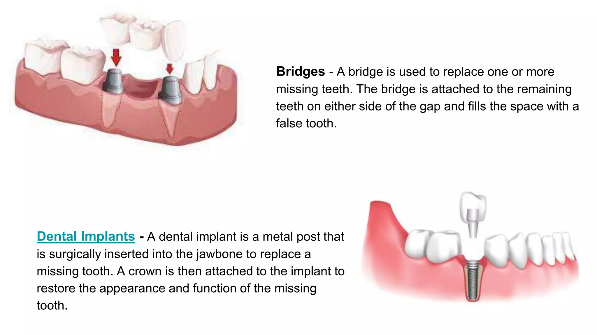 The Basics of Dentistry | PPTX