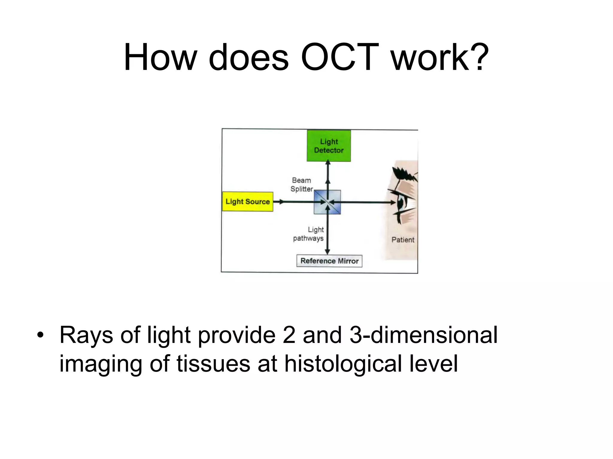 The basics of retinal oct ophso.net