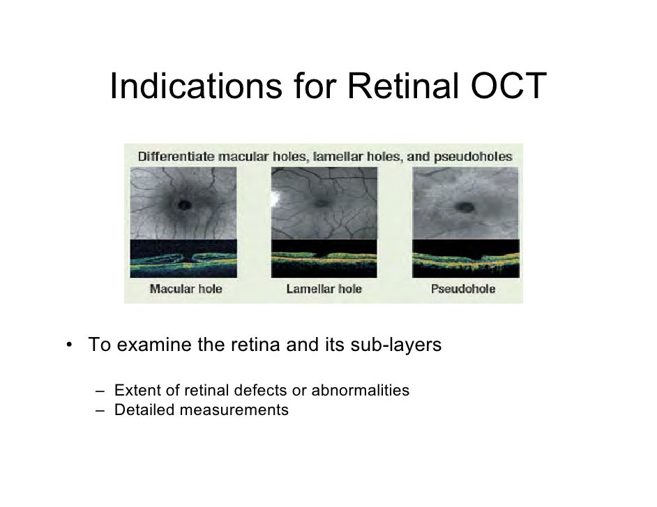 The Basics Of Retinal Oct