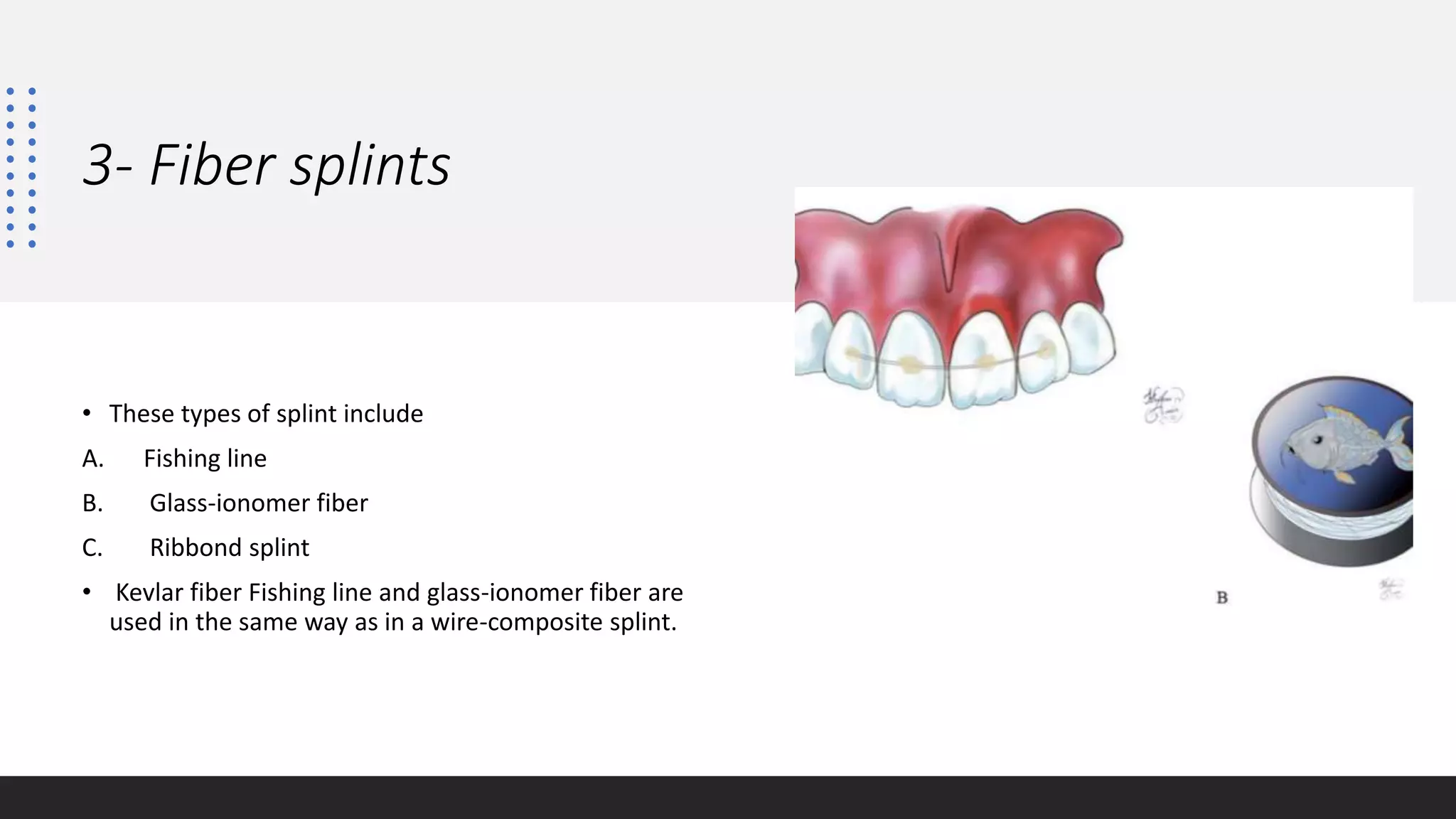 The Basics of Splinting in Dentoalveolar Traumatology.pptx