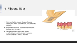 The Basics of Splinting in Dentoalveolar Traumatology.pptx