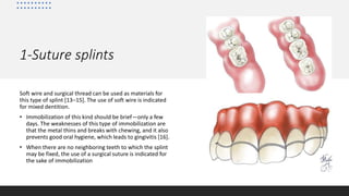 The Basics of Splinting in Dentoalveolar Traumatology.pptx