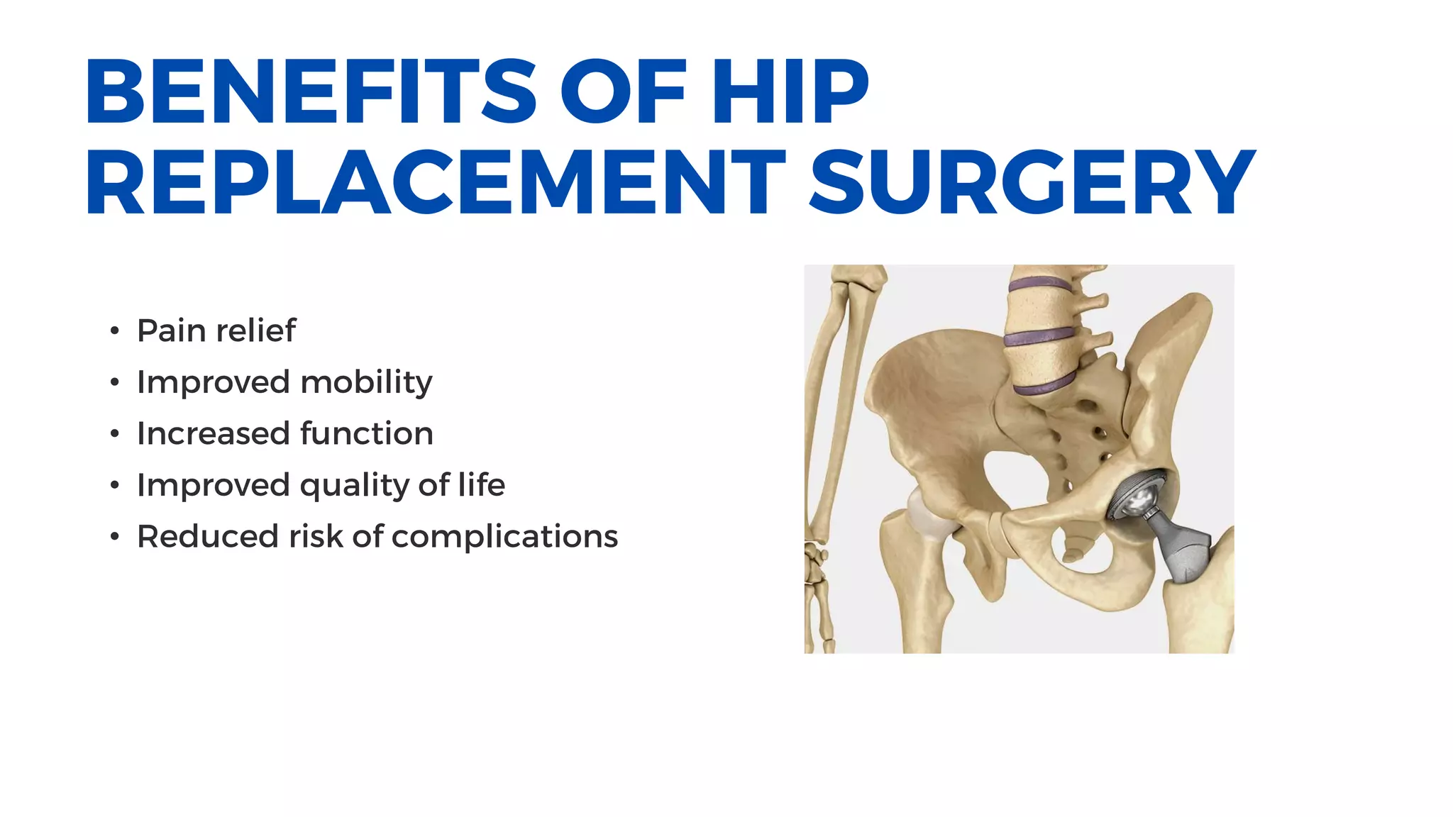 The Benefits of Hip Replacement Surgery.pptx