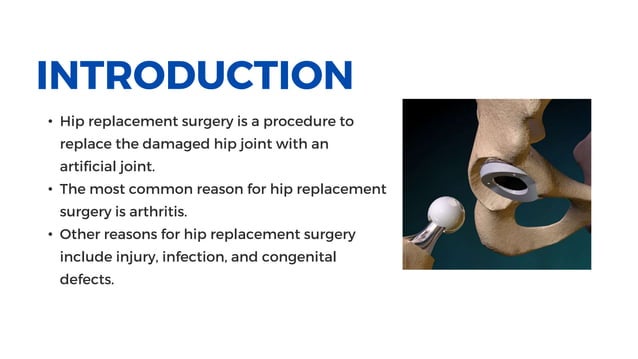 The Benefits of Hip Replacement Surgery.pptx