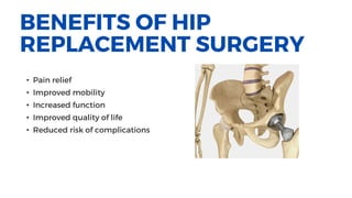 The Benefits of Hip Replacement Surgery.pptx
