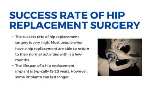 The Benefits of Hip Replacement Surgery.pptx