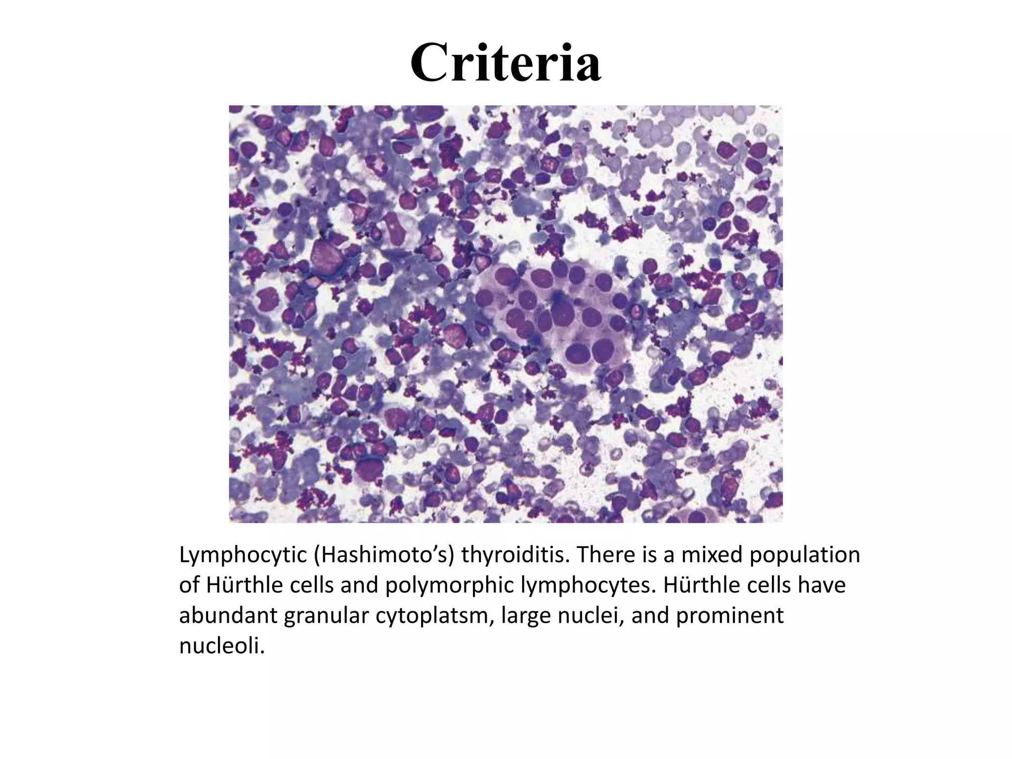 The bethesda system for reporting thyroid cytopathology | PPTX