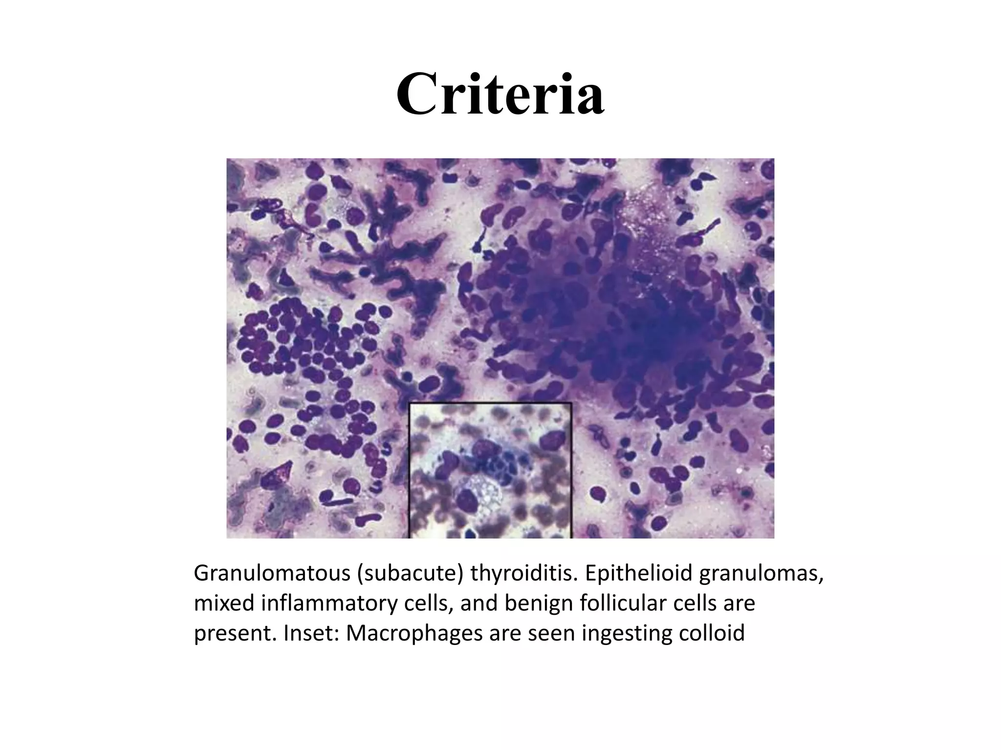 The bethesda system for reporting thyroid cytopathology | PPTX