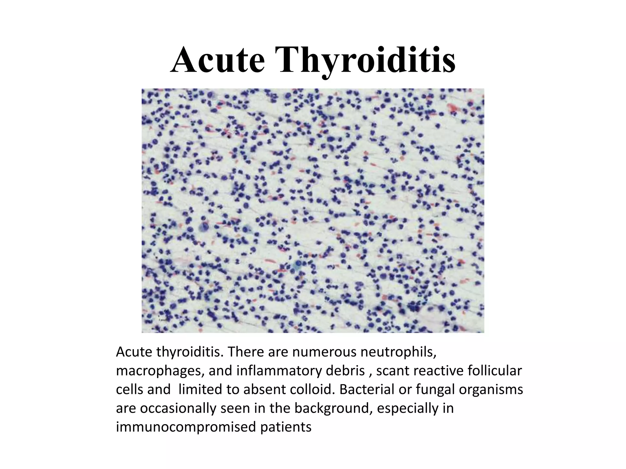 The bethesda system for reporting thyroid cytopathology | PPTX