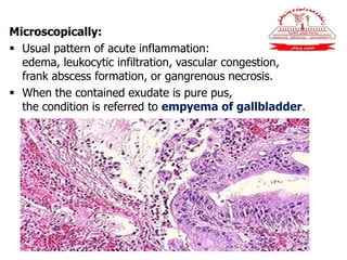 The biliary tract | PPT