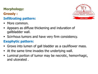 The biliary tract | PPT