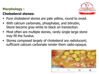 The biliary tract | PPT