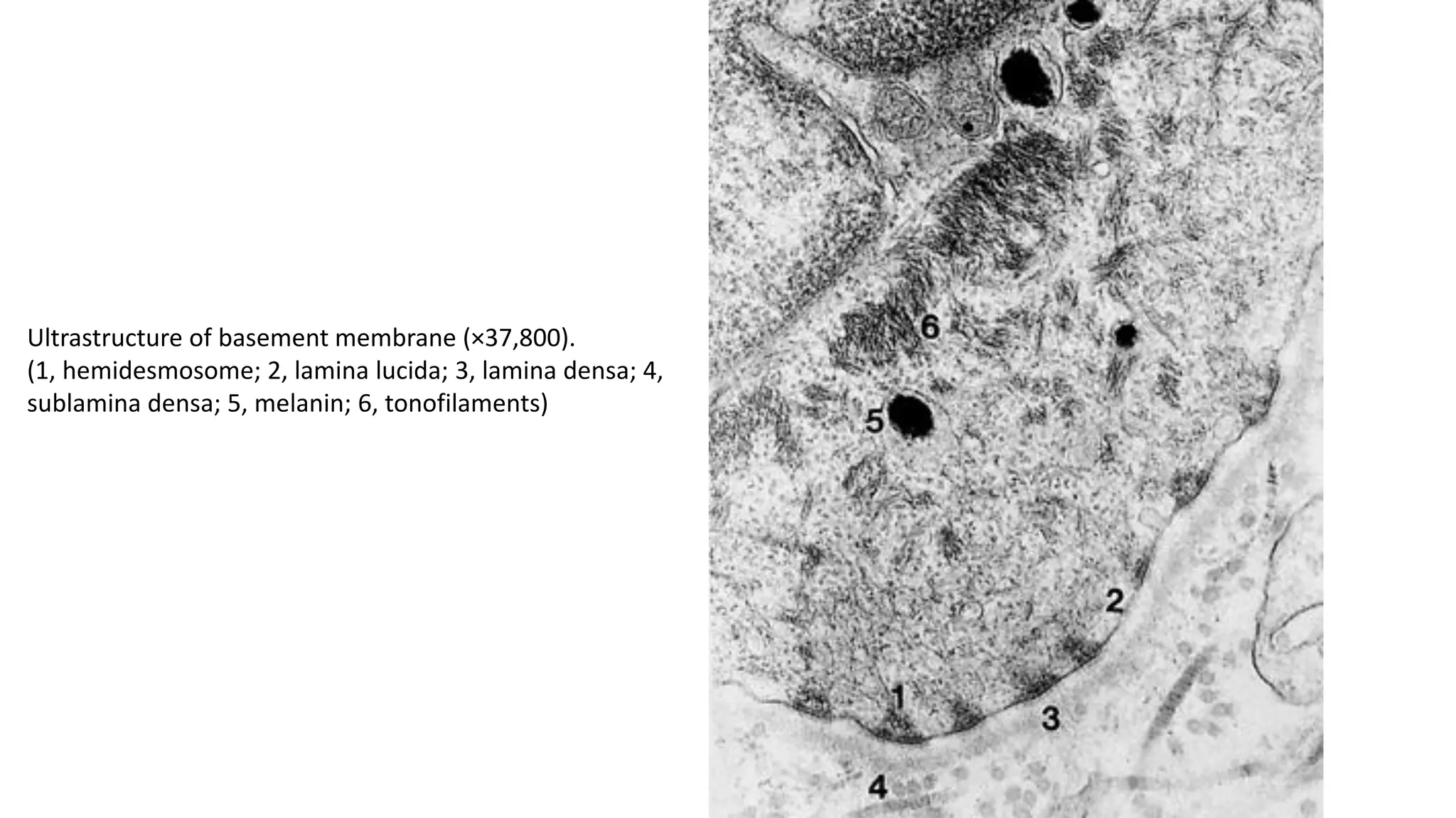 The Biology of the Basement Membrane Zone | PDF