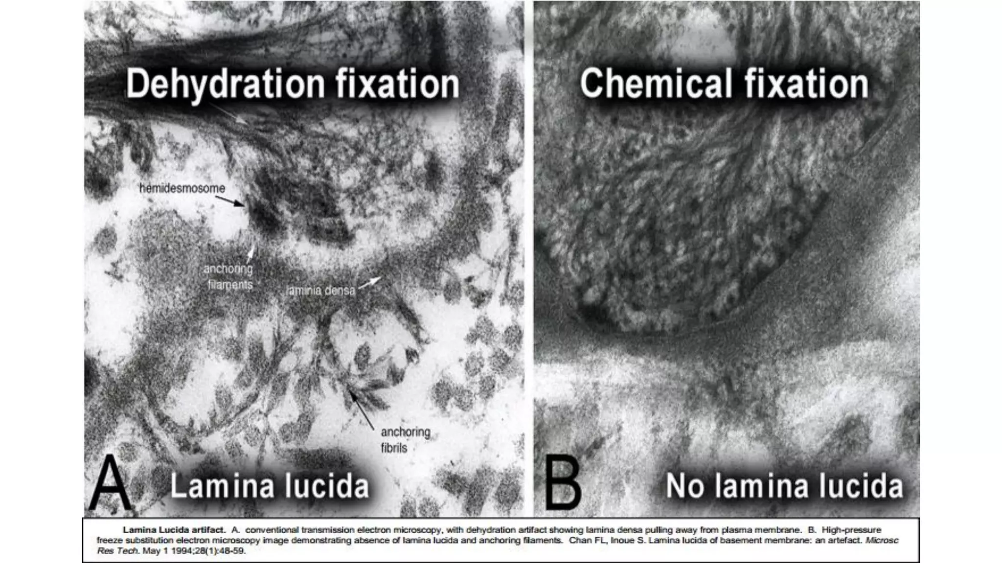The Biology of the Basement Membrane Zone | PDF