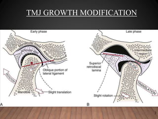 THE BIOLOGY OF TMJ GROWTH MODIFICATION JC 3.pptx