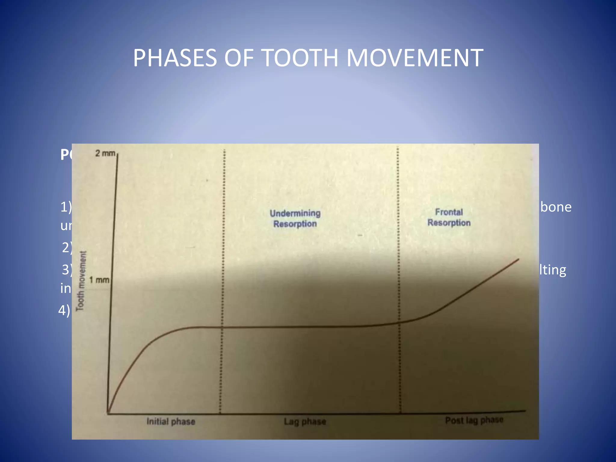 The Biology of tooth movement (Orthodontics) | PPTX