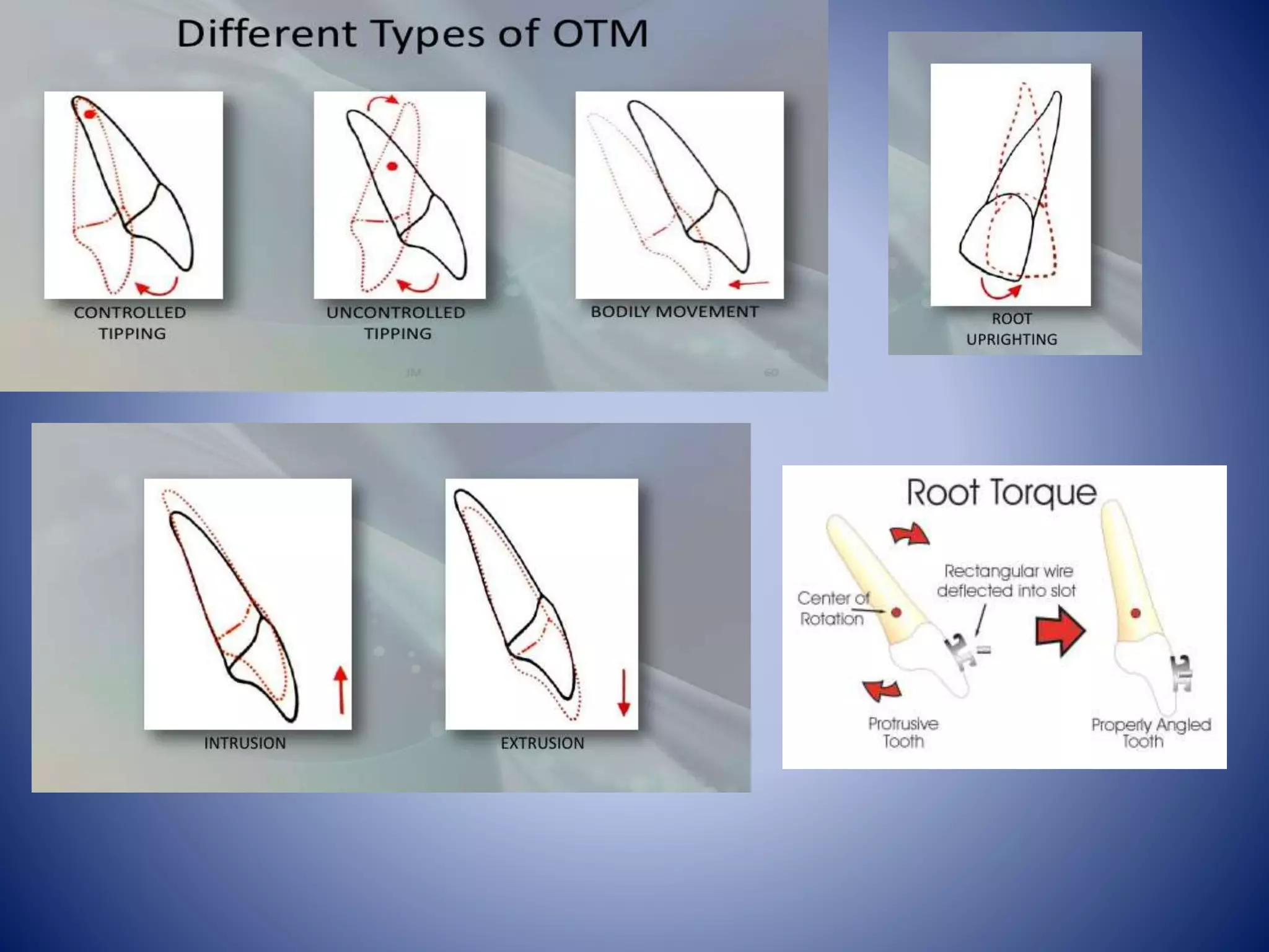 The Biology of tooth movement (Orthodontics) | PPTX