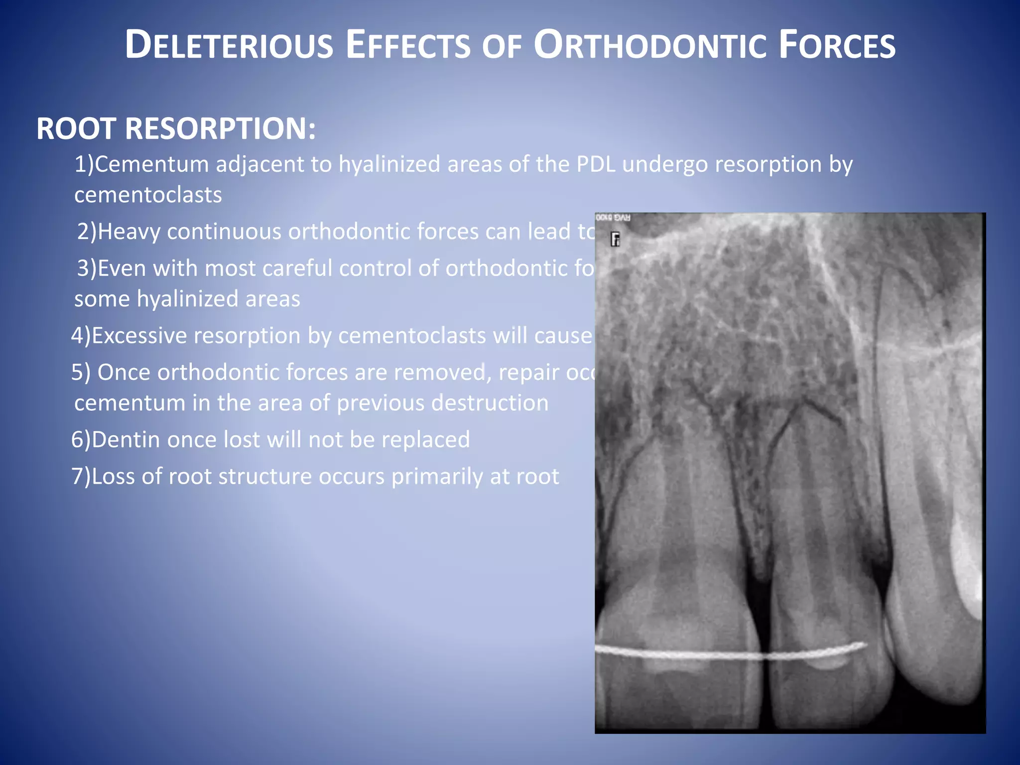 The Biology of tooth movement (Orthodontics) | PPTX