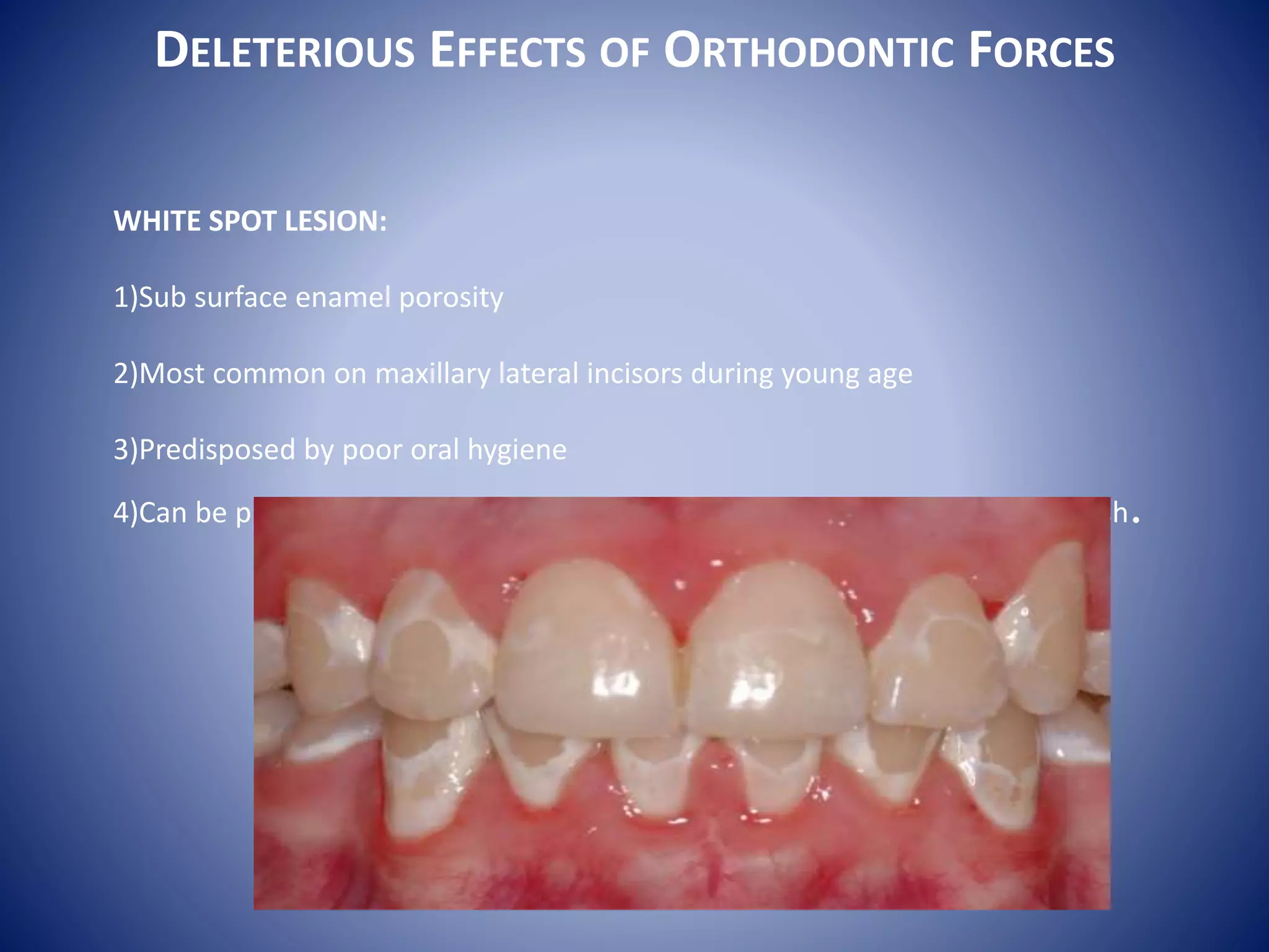 The Biology of tooth movement (Orthodontics) | PPTX