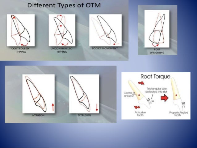 The Biology of tooth movement (Orthodontics)