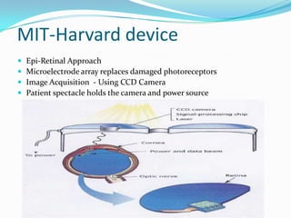 The bionic eye | PPTX