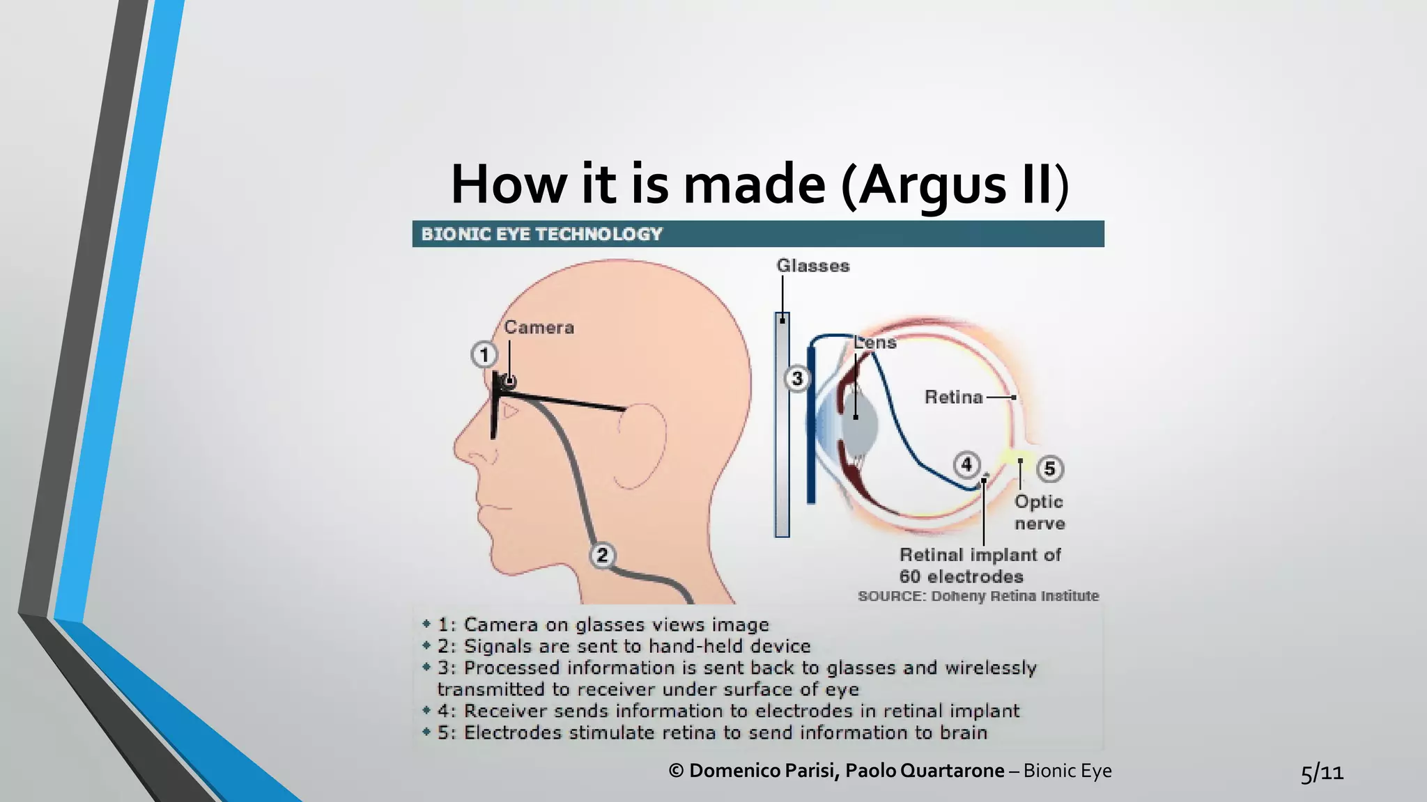 The Bionic Eye...a new vision of the future | PDF
