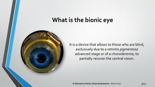 The Bionic Eye...a new vision of the future | PDF