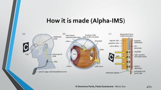 The Bionic Eye...a new vision of the future | PDF