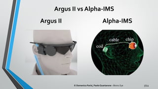 The Bionic Eye...a new vision of the future | PDF