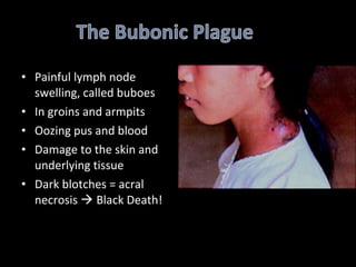 The black death2008 | PPT