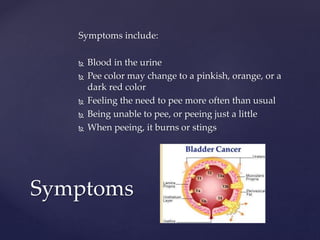 The bladder monirah al khudari | PPT