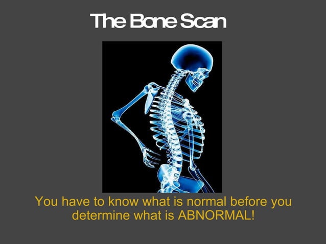 The Bone Scan | PPT