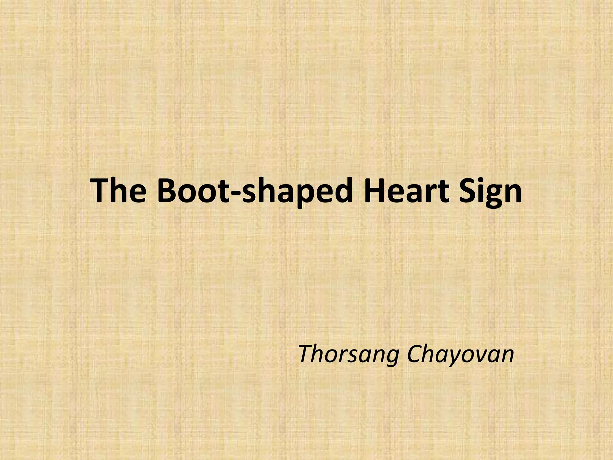 The boot shaped heart sign | PPTX