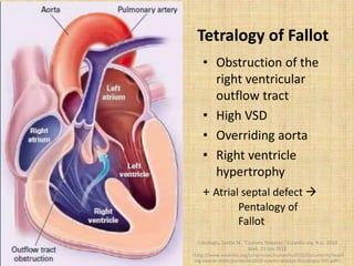 The boot shaped heart sign | PPTX