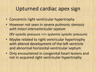 The boot shaped heart sign | PPTX