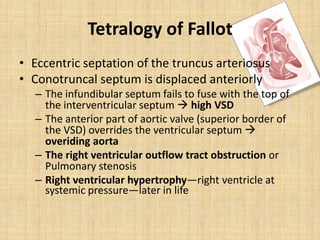 The boot shaped heart sign | PPTX