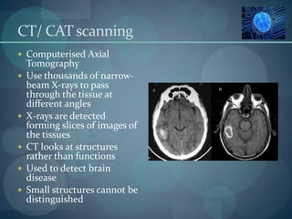 The brain - scans and imaging | PPT