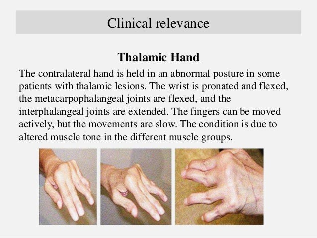 The Brain Anatomy by Dr Arman Hossain