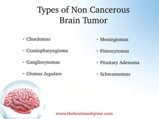 Brain Tumor And Its Types | ODP