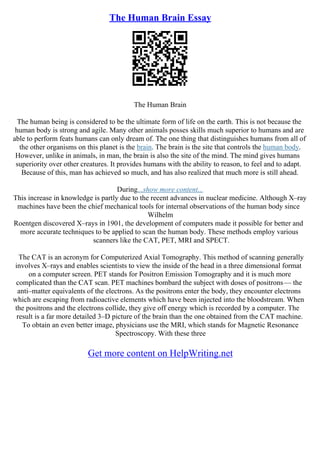 The Brain Essay | PDF
