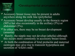 Anatomy of Breast in clinical perspective-Dr.Gosai | PPT