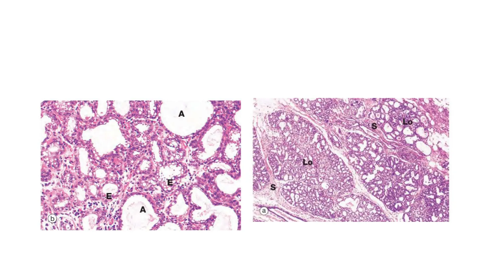 THE BREAST(MAMMERY GLAND].pptx