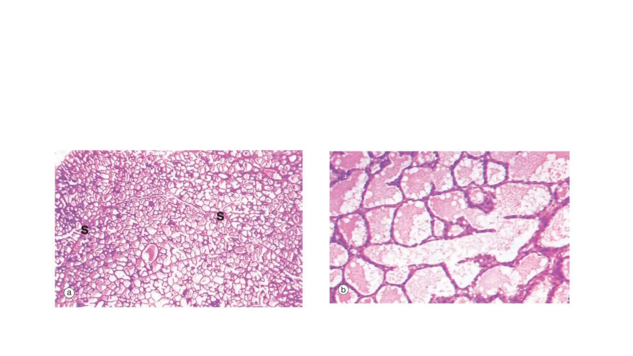 THE BREAST(MAMMERY GLAND].pptx
