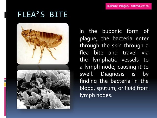 The bubonic plague | PPTX | Infectious Diseases | Diseases and Conditions