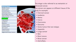 Dispositivaa sobre el Cáncer, en inglés . | PDF